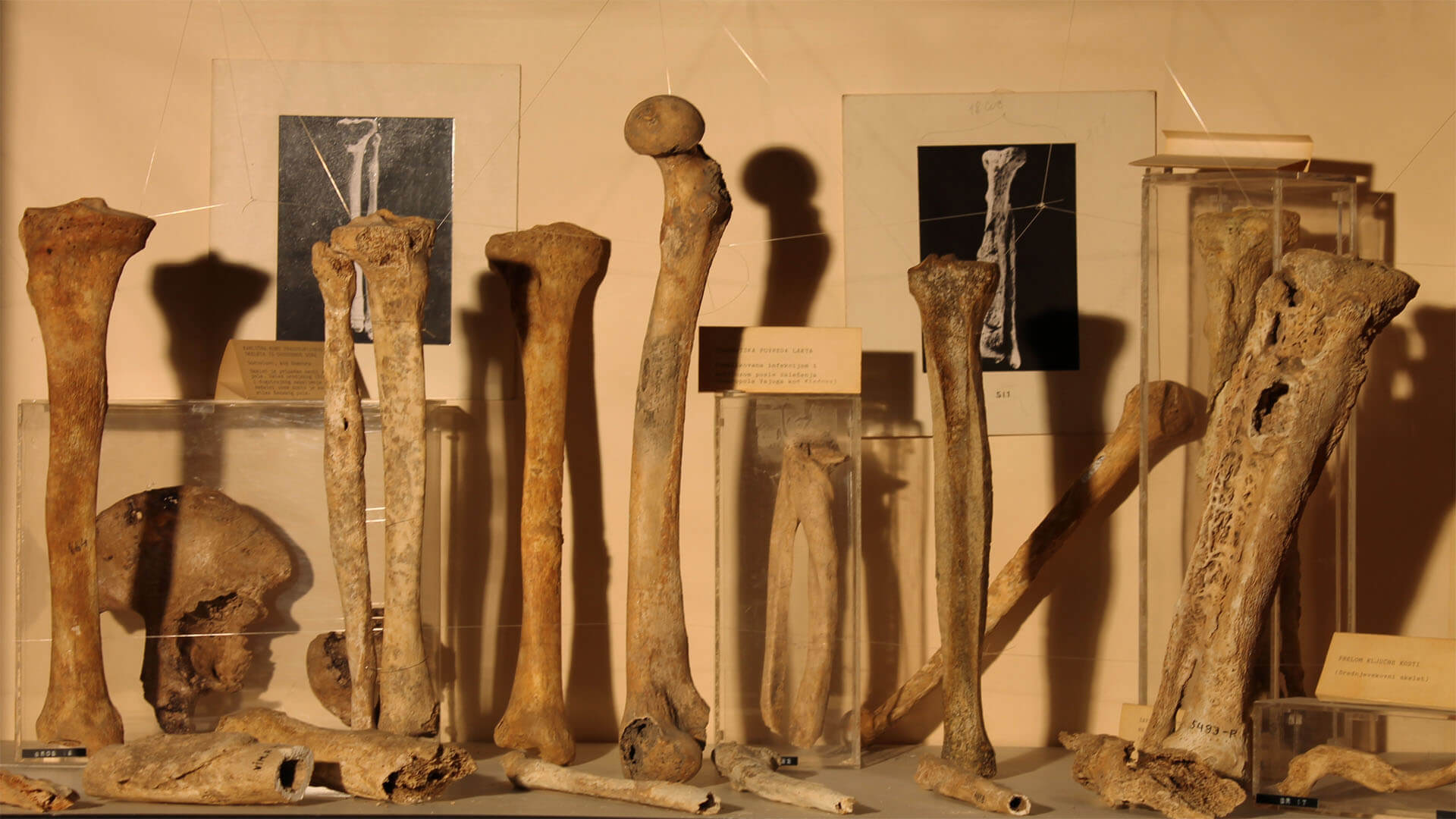 Bioanthropological facilities - Center of Bone biology